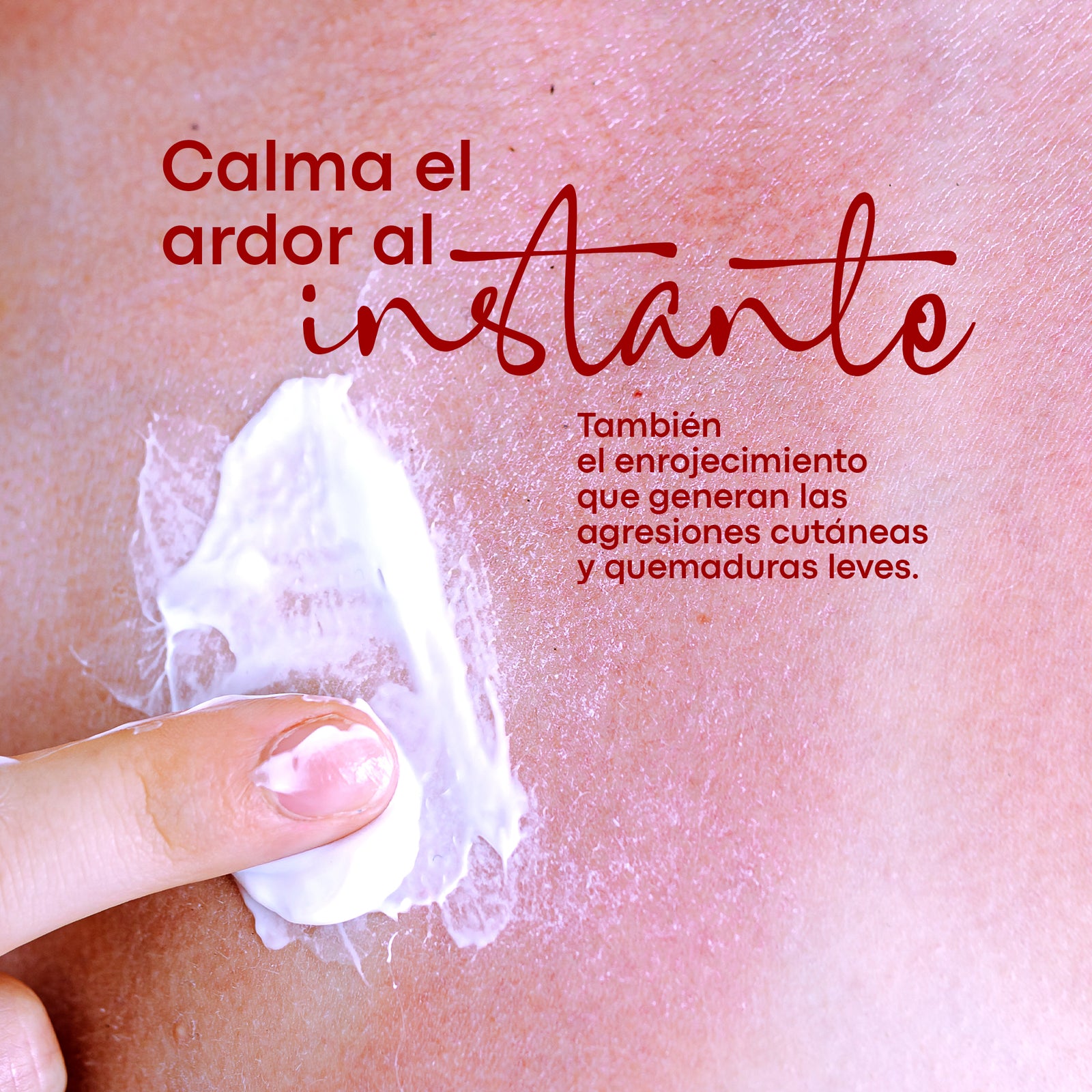 Cicafarm Q | Crema para Quemaduras, Rozaduras y Alivio de Irritación ...