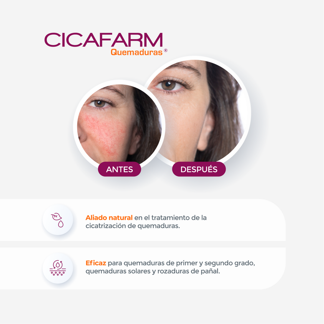 Cicafarm Quemaduras - 100g – Tienda Farmapiel